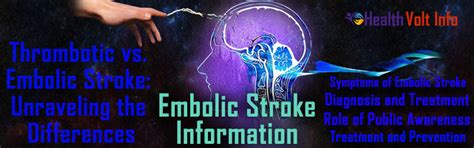 Embolic Stroke Information