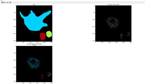 Problems With Per Cell Colocalization Analysis Image Analysis Image Sc Forum