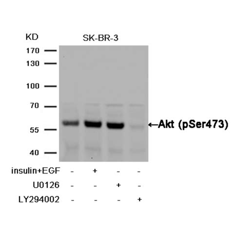 Anti Akt Phospho Ser473 Antibody A50491