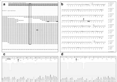 Whole Genome Sequencing Revealed A Point Mutation Base Pair