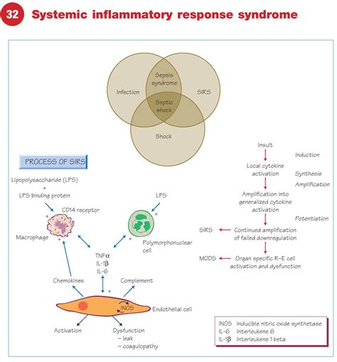 Systemic Inflammatory Response Syndrome Sirs