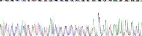 Rpb090hu02 谷胱甘肽s转移酶π1gstp重组蛋白 Homo Sapiens Human，人 Uscn武汉优尔生商贸