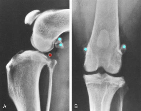 Stifle Joint Flashcards Quizlet
