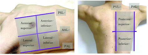 Lung Segmentations In 12 Zone Lung Pocus The Chest Was Divided Into