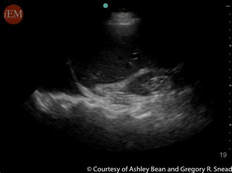 Efast International Emergency Medicine Education Project