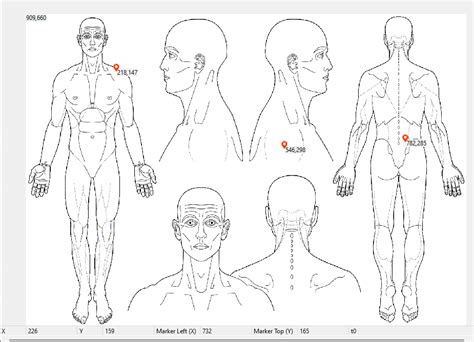 C How To Keep Relative Position Of Timage As A Marker On A Timage Background Image Stack