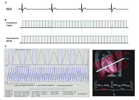 Strategies For The Synchronization Of Cardiac Cine Mri With The