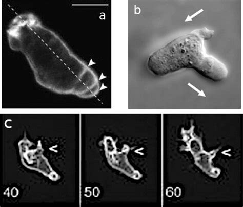 A A Dictyostelium Discoideum Dd Cell Migrating To The Lower Right By Download Scientific
