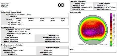Figure 1 From Topography Guided Excimer Laser Ablation In Refractive