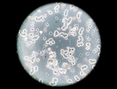 What Do Cancer Cells Look Like Under A Microscope The Interesting Answer Optics Mag