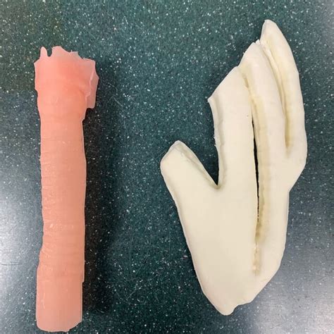 Cross‐sectional View Of 3d‐printed Model Demonstrating Subglottic