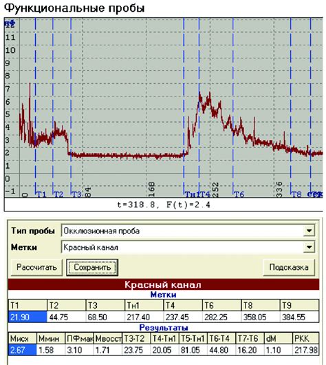 Occlusal Test Normocirculatory Hemodynamic Type Of Microcirculation