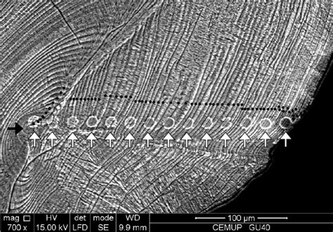 Transverse Section From The Sagittal Otolith Of A 72 Days ­ Old C Download Scientific Diagram