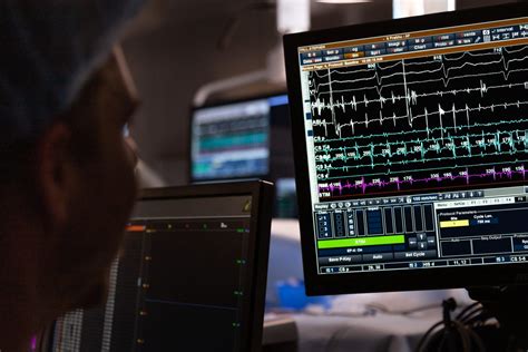 Loop Recorder Implantation Bayside Heart