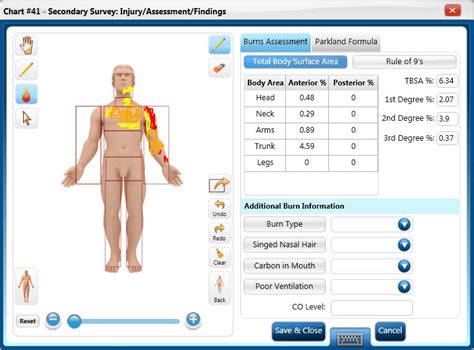 Chart Method Ems Template