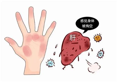 养肝先排毒出现6大身体信号提示你肝毒太多了抓紧排 阿波罗新闻网