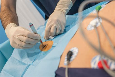 Avanços Na Cirurgia Cardiovascular Conheça Alguns Procedimentos