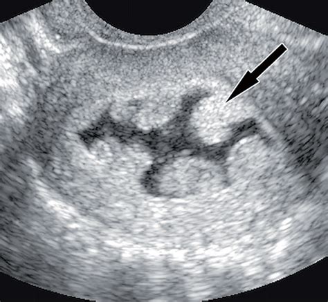 დაავადებები