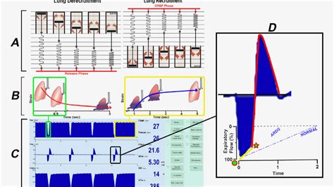 Personalizing Ventilation In Ards The Role Of Tcav And Expiratory Time Adjustment Based On