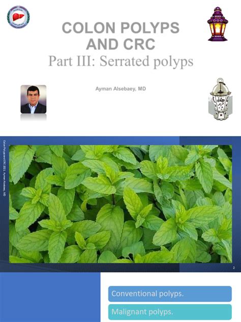 Colon Polyps And Crc Part Iii Serrated Polyp 2021 Pdf Colorectal Cancer Science And Mathematics