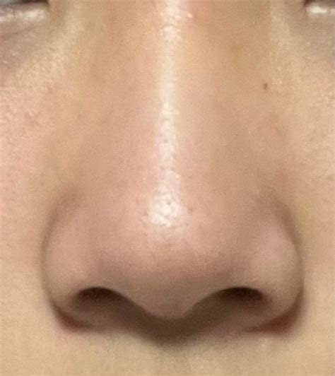 복코인가요 코 못생긴편인가요 ㅠㅠ 지식in