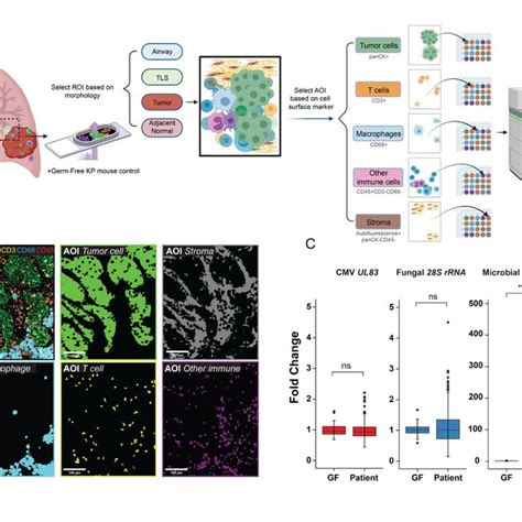 Spatial Meta Transcriptomic Analysis Of Lung Cancers A Study Scheme