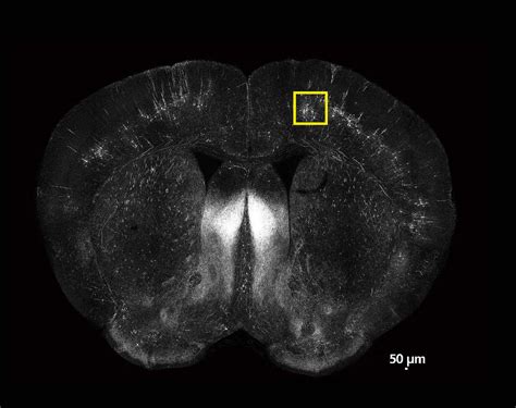 AX R MP with NSPARC AX R MP with NSPARC 共聚焦和多光子显微镜 显微镜产品 尼康精机上海有限公司