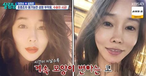 이천수 아내 심하은 코 성형 부작용에 “징그럽다” 막말 살림남2 Tv체크