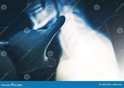 Xray Scan Examination Stock Photo Image Of Healthcare 78527280