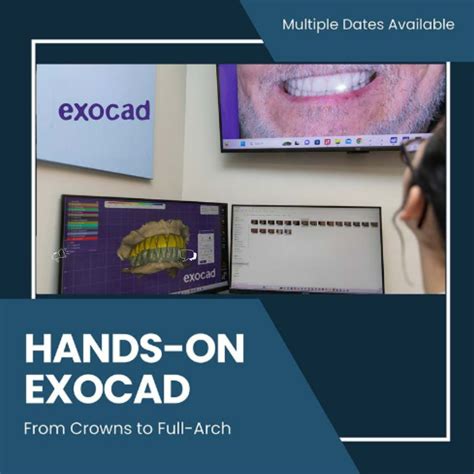 Hands On Exocad Course