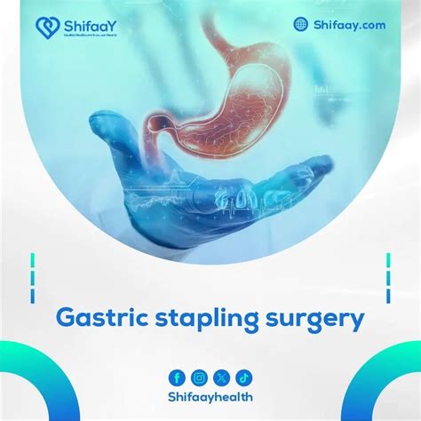 Gastric Stapling Surgery Shifaay