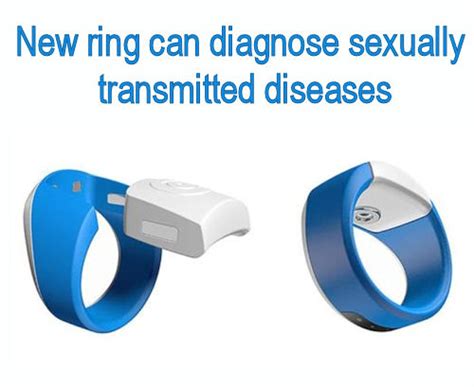 Medical Laboratory And Biomedical Science POCT Ring Can Diagnose Sexually Transmitted Diseases