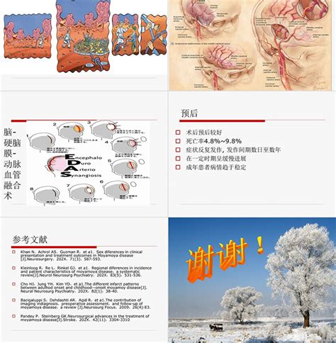 有关烟雾病PPT素材 卡卡办公