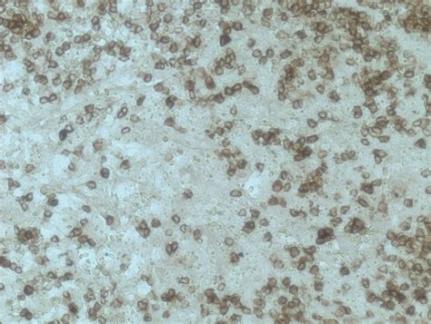 Dlec Clec4c Bdca 2 Antibody [unconjugated] Af1376 Novus Biologicals