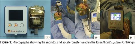 Figure 1 From Using Accelerometer Based Portable Navigation To Perform Accurate Total Knee