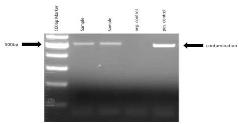 Homemade Pcr Test For Mycoplasma Contamination