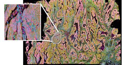 Xenium® Spatial Analyzer Biochain Spatial Biology