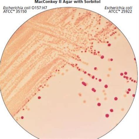 Stool Overt Pathogens Flashcards Quizlet
