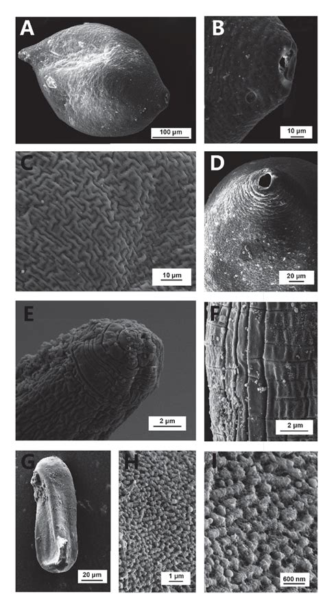 Sem Micrographs Of Cactodera Chenopodiae N Sp A Cyst B Vulval Cone Download Scientific
