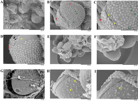 Scanning Electron Micrographs Of Poorly Developed Ad And Fully