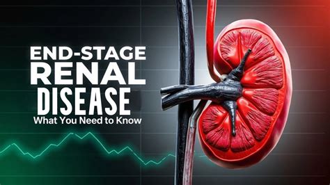End Stage Renal Disease Esrd