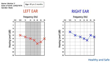 SOLVED What Type Of Simple Calculations Can Be Used To Determine The Outcome Of An Audiometry