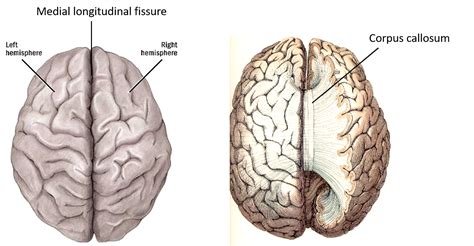 Left Hemisphere Of The Brain Definition