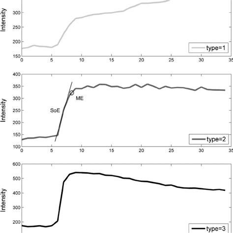 Parameters Related To The Time Intensity Curve Type Slope Of