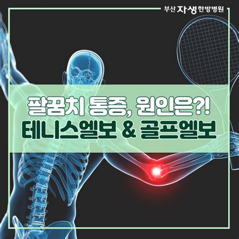 [팔꿈치가 아파요] 팔꿈치 통증 혹시 나도 테니스엘보and골프엘보 네이버 블로그