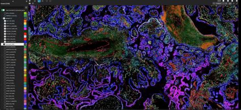 Developing Spatial Transcriptomics Data Analysis Solutions To Empower Researchers Vizgen