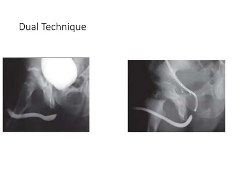 Retrograde Urethrogram For Urology Residents Pptx