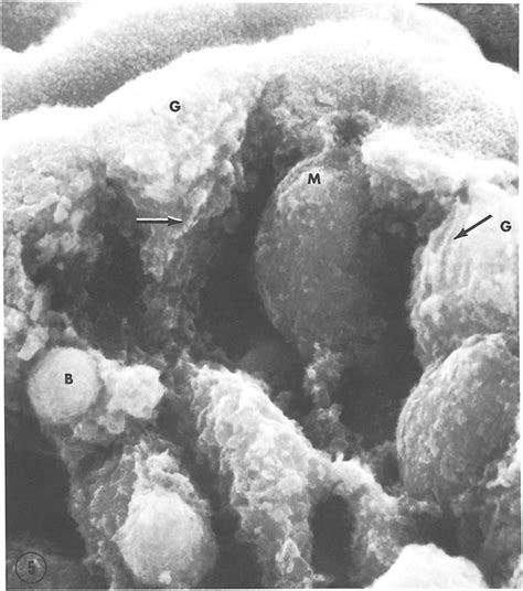 A Lateral View Of The Mucosal Epithelium Of The Toad Urinary Bladder
