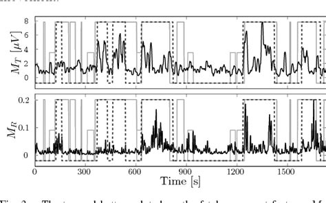 Figure 1 From Fetal Movement Detection Based On Qrs Amplitude