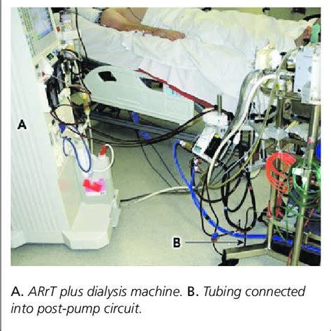 Use Of The Fresenius 4008s Arrt Plus Machine Connected Into The Ecmo Download Scientific